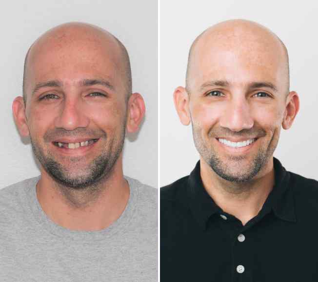 Revived Smiles | Revive Dental Implant Center