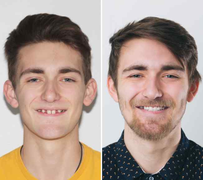 Revived Smiles | Revive Dental Implant Center