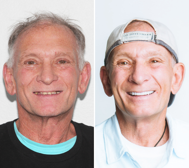 Revived Smiles | Revive Dental Implant Center