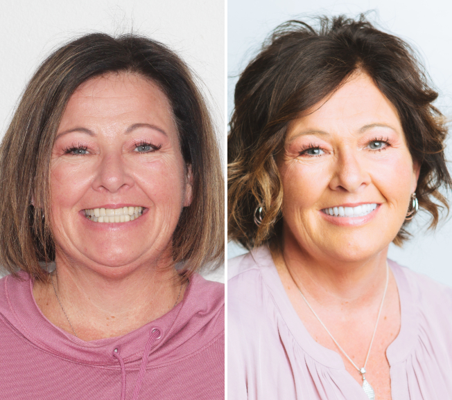 Revived Smiles | Revive Dental Implant Center