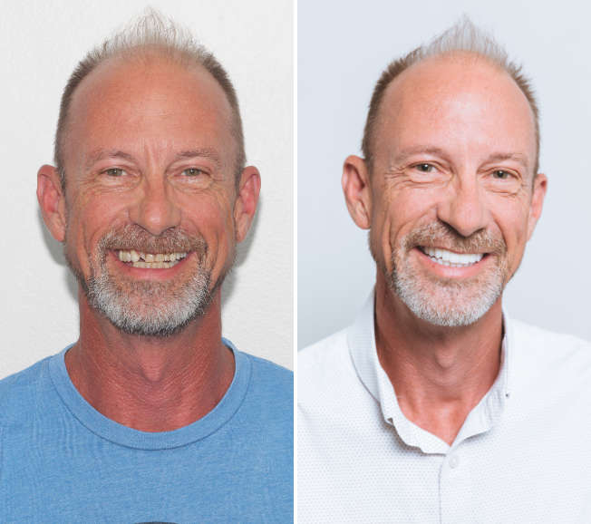 Revived Smiles | Revive Dental Implant Center