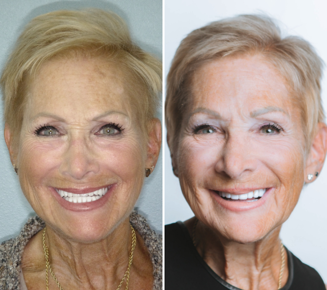 Revived Smiles | Revive Dental Implant Center