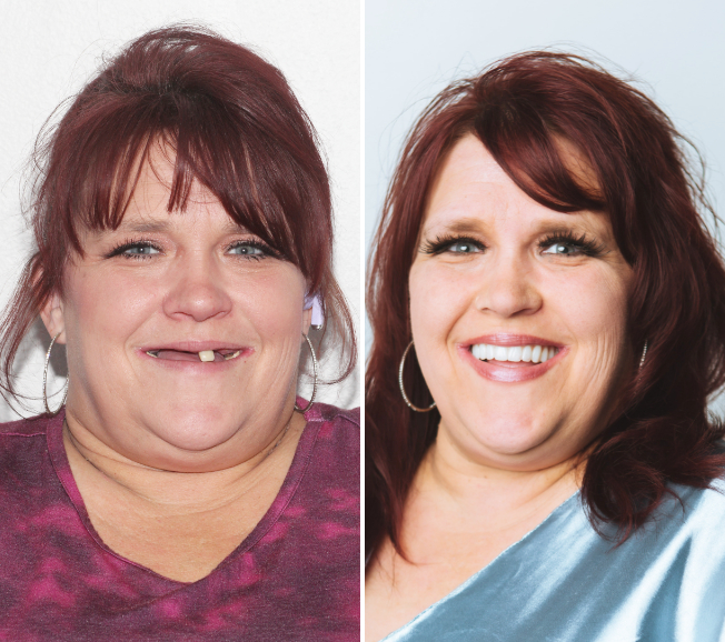 Revived Smiles | Revive Dental Implant Center